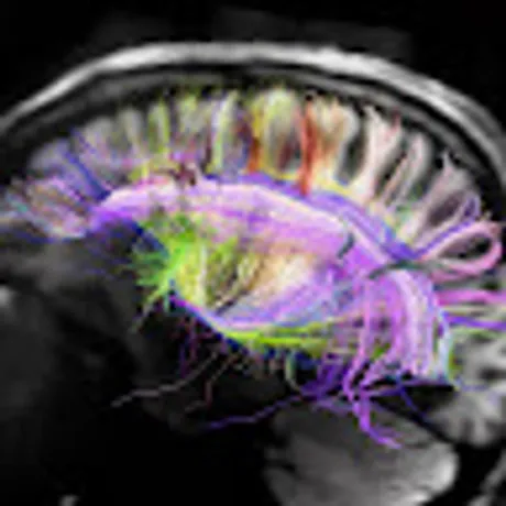 Tarin Ziyaee | Observable